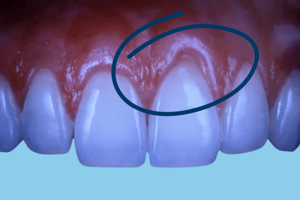 Anatomia dentale: cosa sapere - Studio Dentistico Vignoletti - Dentista ...