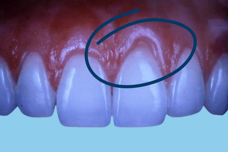 Anatomia dentale: cosa sapere - Studio Dentistico Vignoletti - Dentista ...